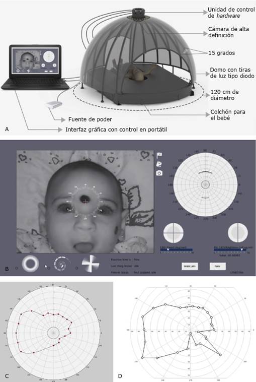 Perimetría computadorizada no estandarizada | Queupumil Rodríguez ...