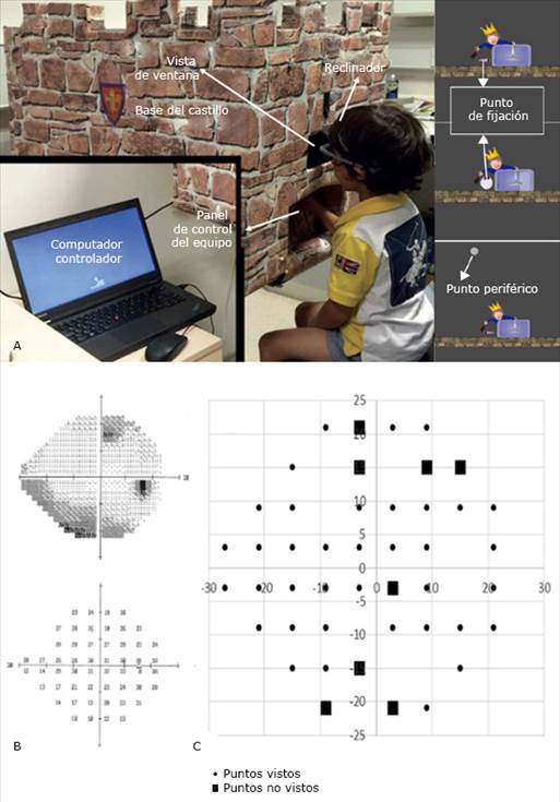 Perimetría computadorizada no estandarizada | Queupumil Rodríguez ...